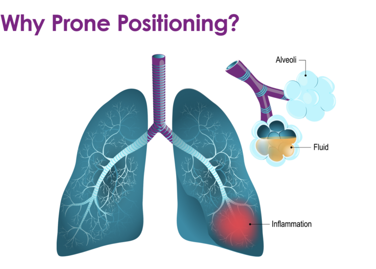 Why Prone Positioning? | Turn Medical Why Prone Positioning?