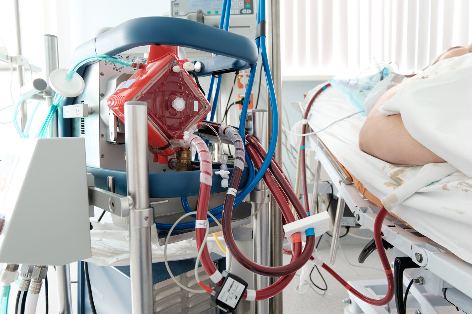 Prone Positioning And ECMO | Turn Medical